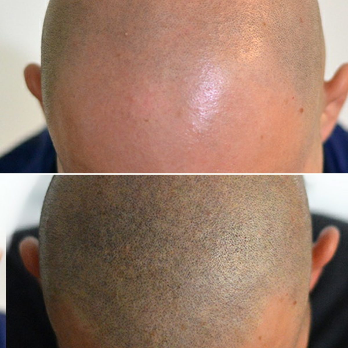 Permanent Makeup & Microblading Training